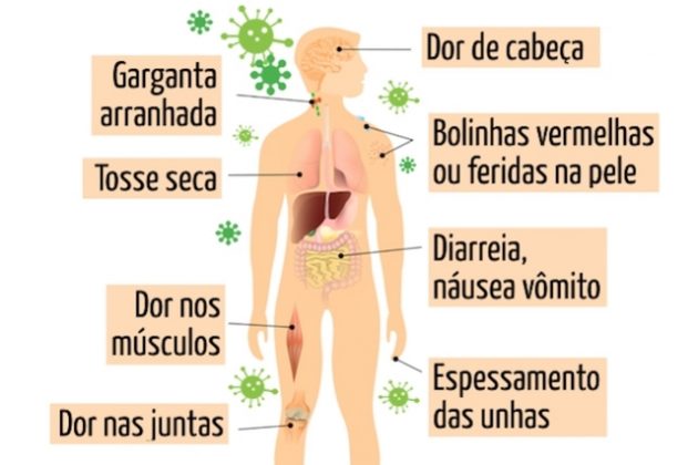 Como a AIDS se manifesta no organismo humano? - Mundo Inverso